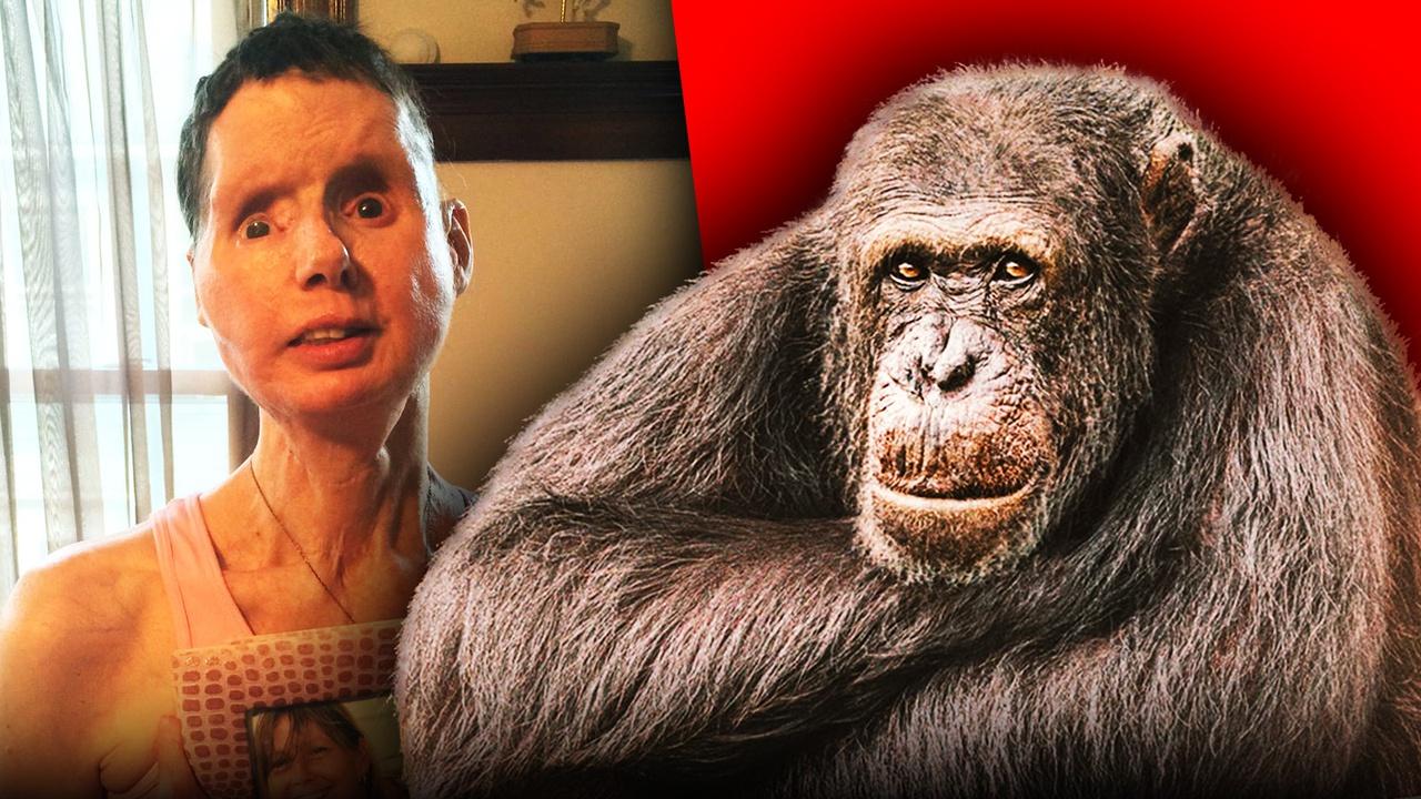 Charla Nash agora em 2024: o que aconteceu com a vítima maluca do chimpanzé | Universo Cinema